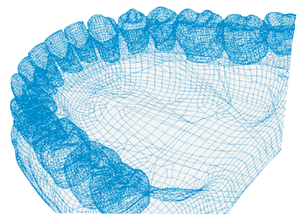 3D Aligner Smile Club – Bringing your smile back to life